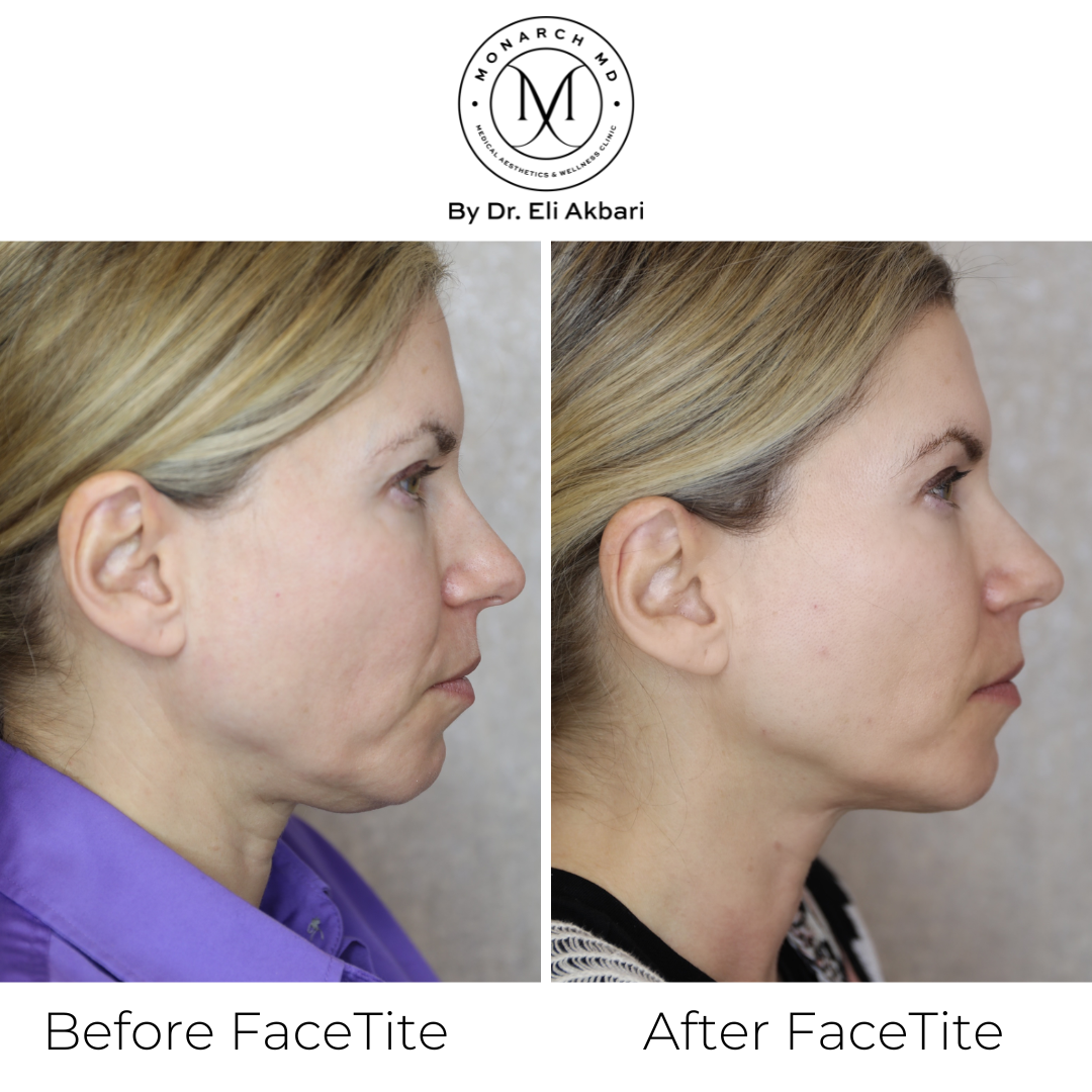 Gallery - Cosmetic Club MD