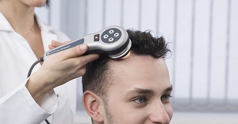 Hair-Loss Analysis - North Vancouver